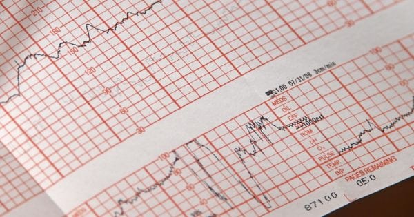 Complete Job Description of a Telemetry Nurse - Top RN to BSN